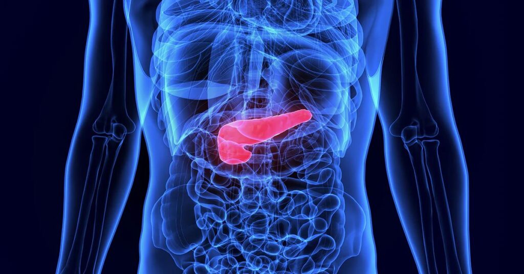 Pancreatitis Treatment - Mehmet Çağlıkülekçi